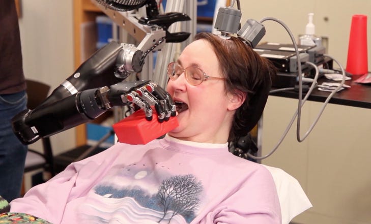 Revolutionizing Healthcare: An Overview of Brain-Computer Interface and ...