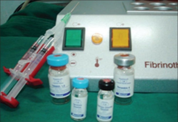 What are the main components of fibrin glue and how are they sourced ...