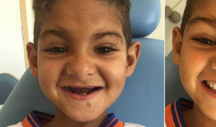 ‘Agora posso rir porque tenho meus dentes’, afirma garoto que teve ...