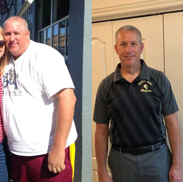 SHOCKING: How I Managed To Lose 420 Lbs Of Ugly Fat Without Any ...