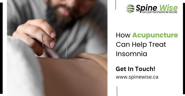 How Acupuncture Can Help Treat Insomnia | by Jacob Lucas | Aug, 2024 ...