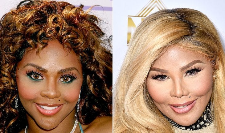 Light skin & it’s link to success in Africa | by Dr Ola Brown ...