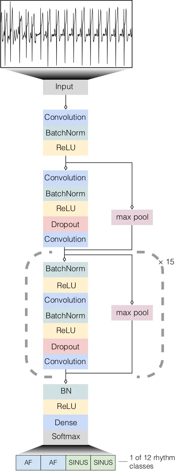 The most insightful stories about Ecg - Medium