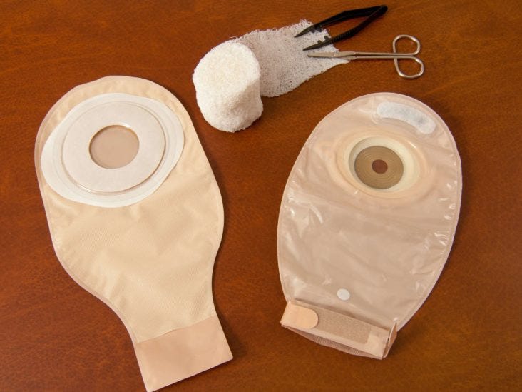 The Treatment Of Ostomy Care Patients Involves A Variety Of Practical ...