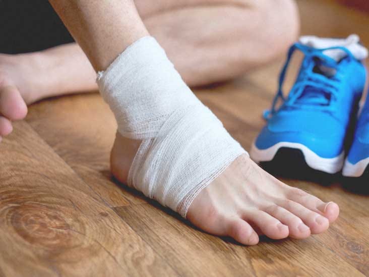 WHAT LEADS TO CUBOID SYNDROME?. The Cuboid bone is one of the 7 tarsal ...
