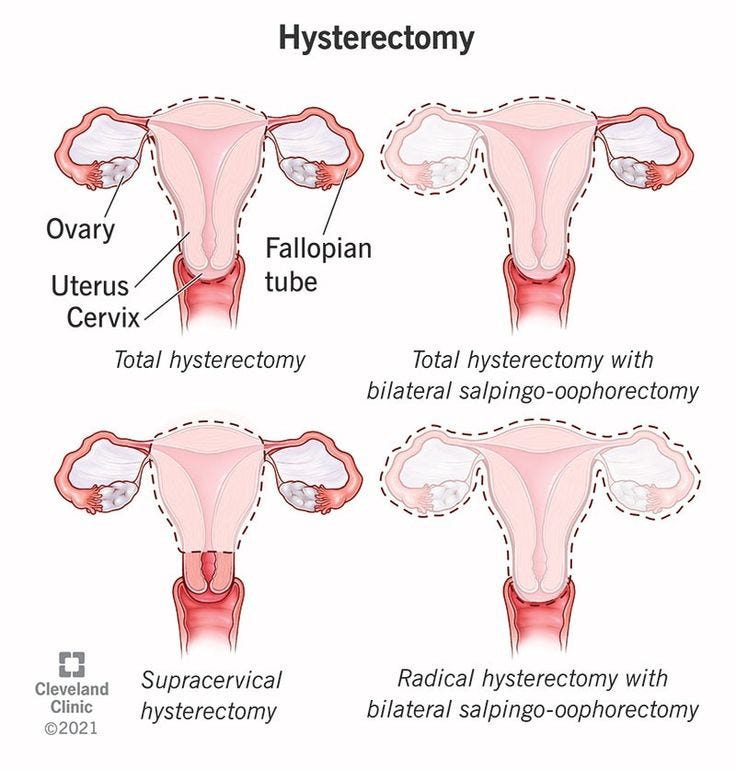 Hysterectomy Explained: What You Need to Know:: | by Uzair Khan | Nov, 2024 | Medium