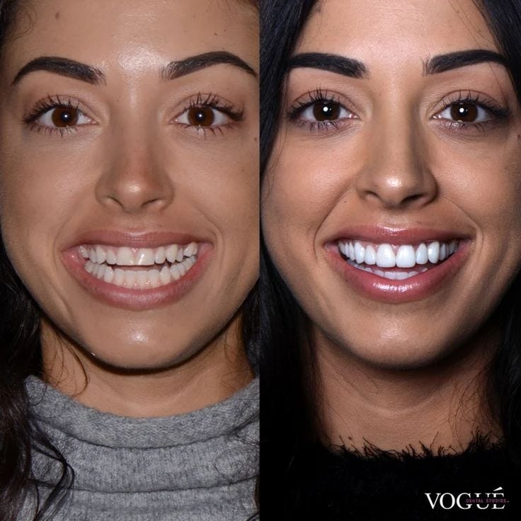 Did you know the color of your teeth has a direct effect on your ...