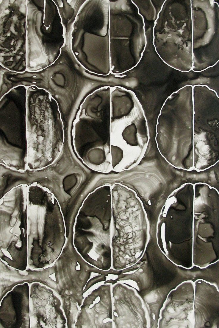 TheHuman Brain is Scary. The brain’s wild, even when it’s… | by carmen ...