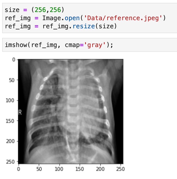 Identification of pattern growth in image analysis | by Brij Dwivedi ...