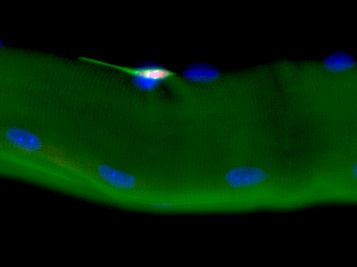 Package delivery to boost repair of muscular dystrophy muscle | by ...