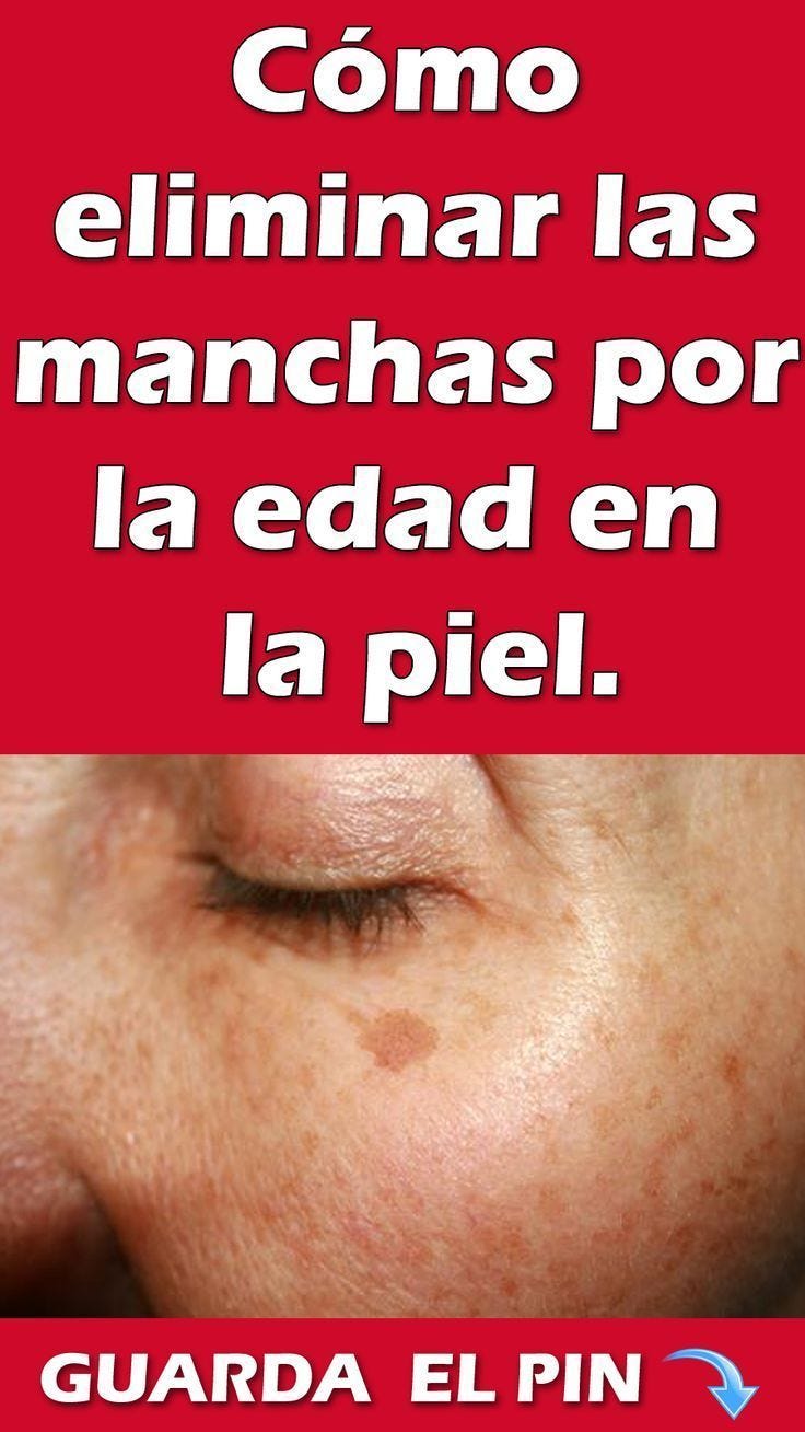 Cómo quitar las manchas de la cara con remedios infalibles - Doctor Consejos - Medium