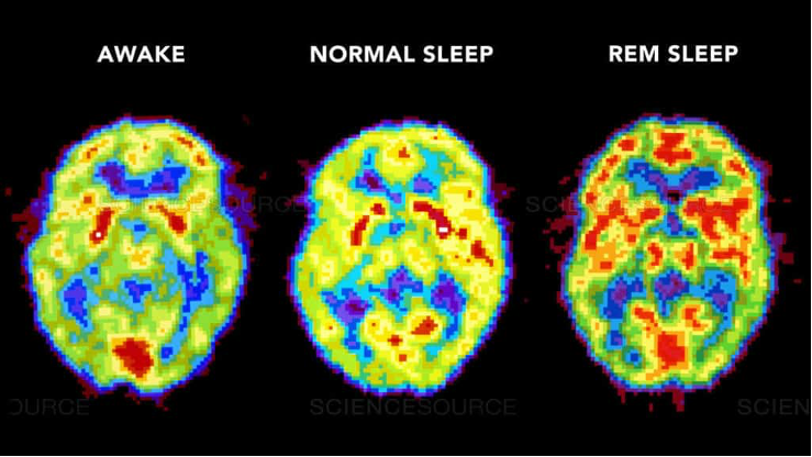 The Mind Never Sleeps. Most people often think of sleep as a… | by ...