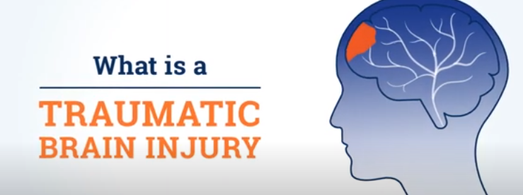 Traumatic Brain Injury and Memory Formation | by Amani Dorsey | Medium
