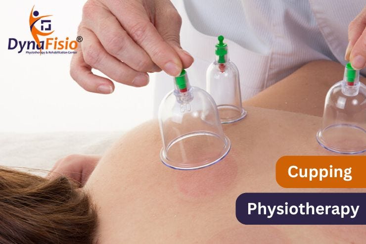 Understanding the Science Behind Cupping Therapy | by DynaFisio | Jun, 2024 | Medium