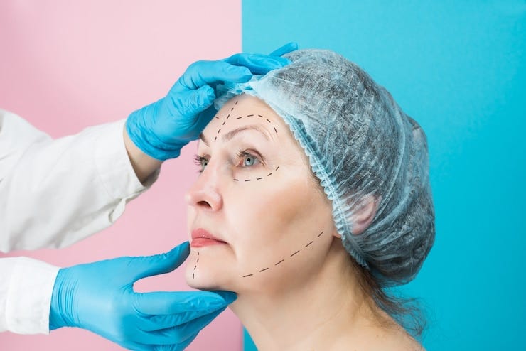 How Facelift Surgery Can Refresh Your Look | by Bilalraja | Apr, 2025 ...