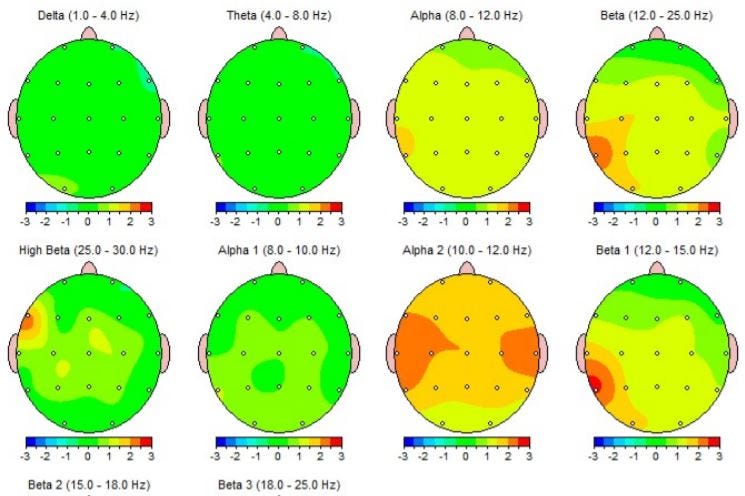 What it’s like to have a brain in permanent flow state — a qEEG report ...