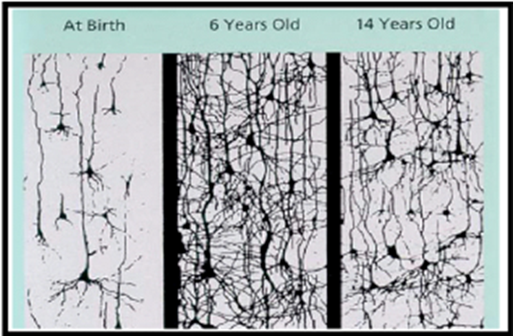 Early Intervention in. Neurodevelopmental disorders | by Dr Shruti Kumar | Medium