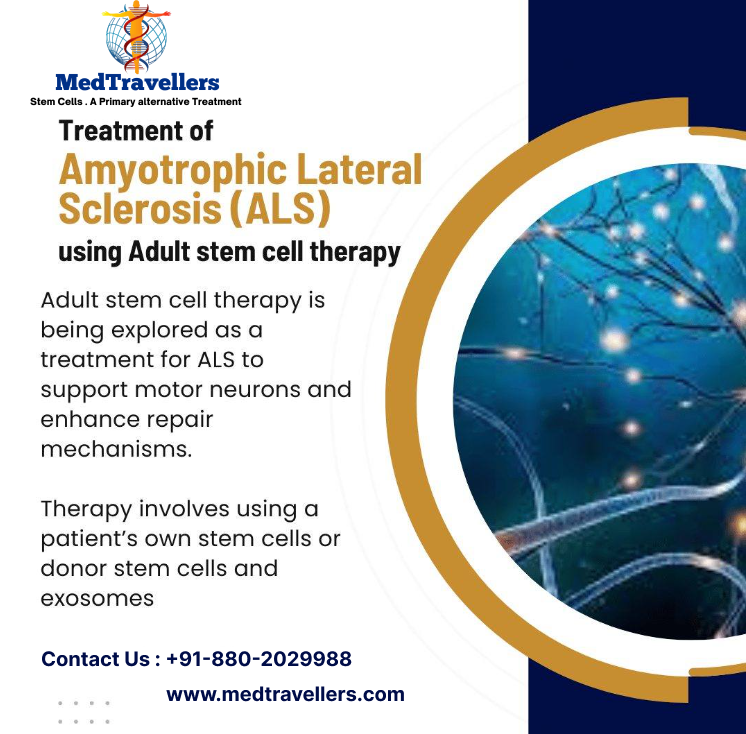 MedTravellers: Stem Cells as a Primary Alternative Treatment for ALS ...