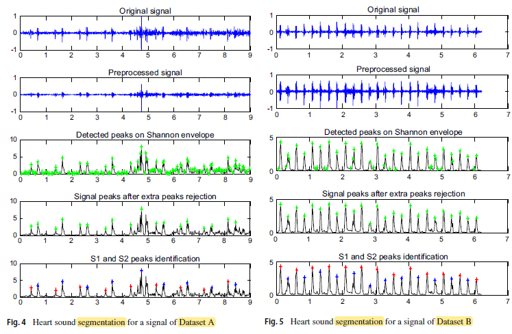 Brief Review — Phonocardiogram Signals Processing Approach For Pascal Classifying Heart Sounds