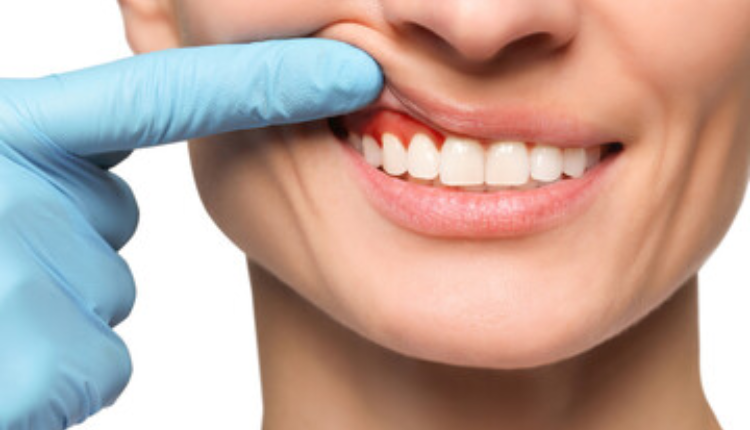 Unveiling the Best Gums Treatment Doctors in Badlapur | Medium