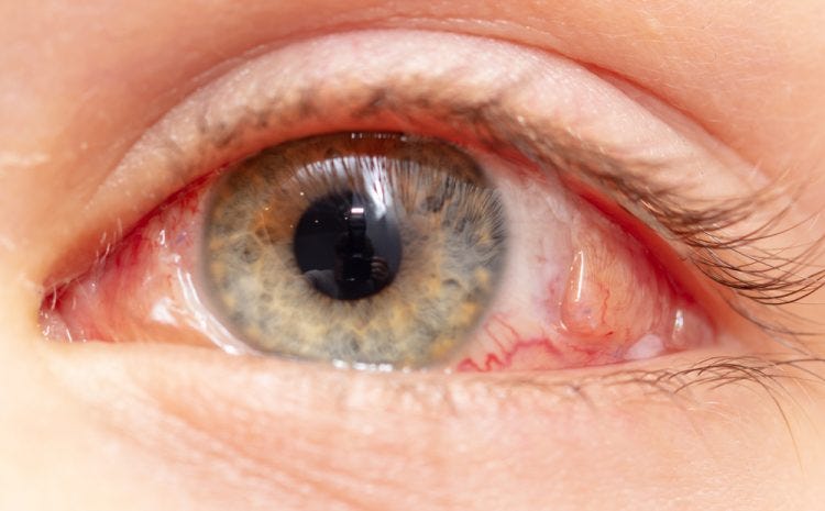 What are the symptoms of retinal detachment? - Eye Doctor in Mumbai- Dr ...