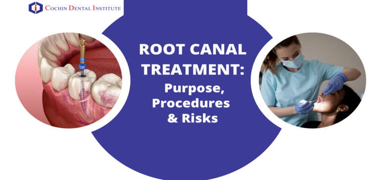 ROOT CANAL TREATMENT: Purpose, Procedures and Risks. - cochin dental ...