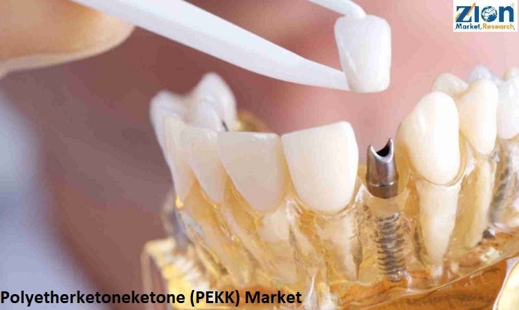Navigating Innovation: A Comprehensive Analysis of the Global Polyetherketoneketone (PEKK ...