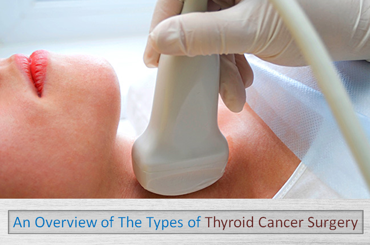 An Overview of The Types of Thyroid Cancer Surgery | by Cancer Care ...