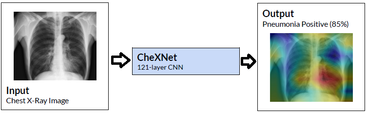 Review — CheXNet: Radiologist-Level Pneumonia Detection on Chest X-Rays ... Review — CheXNet: Radiologist-Level Pneumonia Detection on Chest X-Rays ...