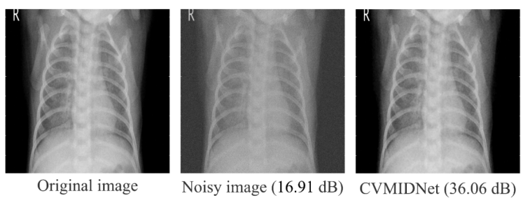 Complex-Valued CNNs for Medical Image Denoising | by Shubhankar Rawat | Towards Data Science