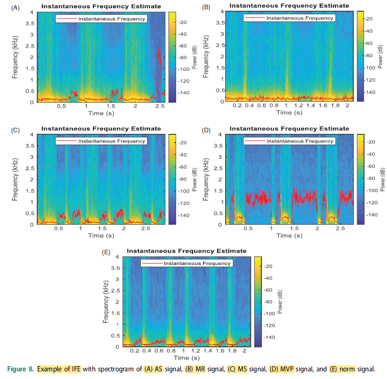 Brief Review — Towards Classifying Non Segmented Heart Sound Records Using Instantaneous