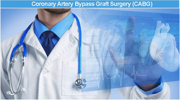 Coronary Artery Bypass Graft Surgery (CABG) | by Magnus Medi | Medium