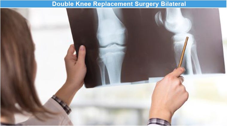 Double Knee Replacement Surgery (Bilateral) | by Magnus Medi | Medium