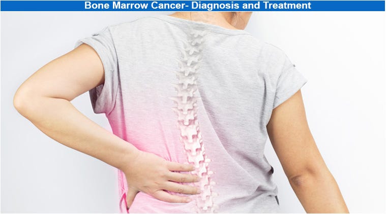 Bone Marrow Cancer- Diagnosis and Treatment | by Magnus Medi | Medium