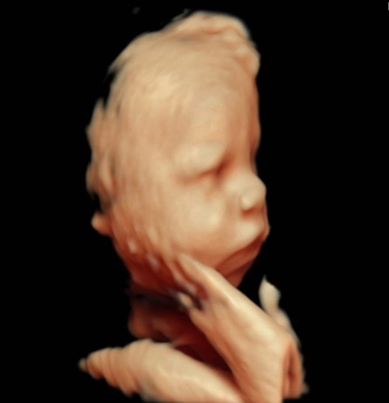 Whole (26Mar24). by no one | by Shawn Cumberland | Medium