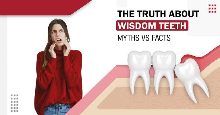 Here are some myths vs facts about wisdom teeth by Kiran Dental Clinic ...