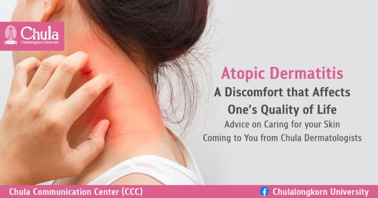“Atopic Dermatitis”: A Discomfort that Affects One’s Quality of Life ...