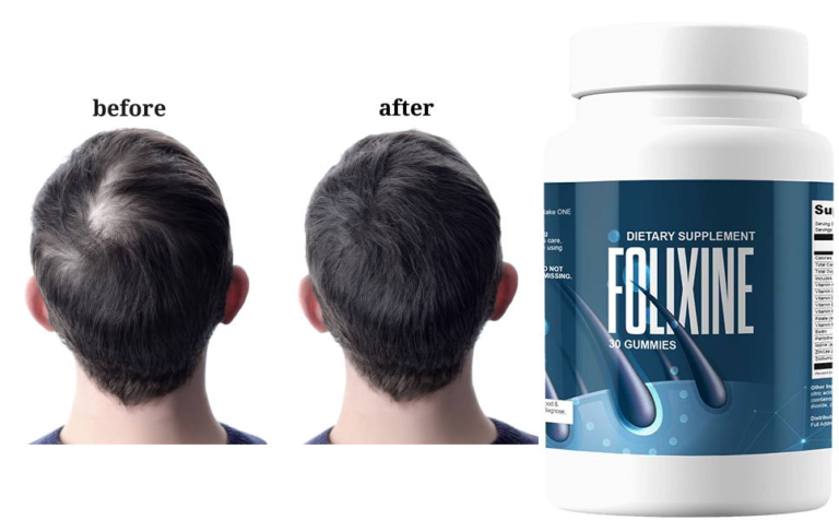Folixine Hair Gummies Official Website, Reviews & Price | by Limitless ...