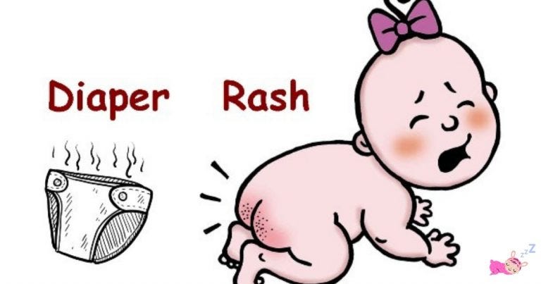 How to avoid diaper rash in your newborn | by Mohiuddin porag | Medium