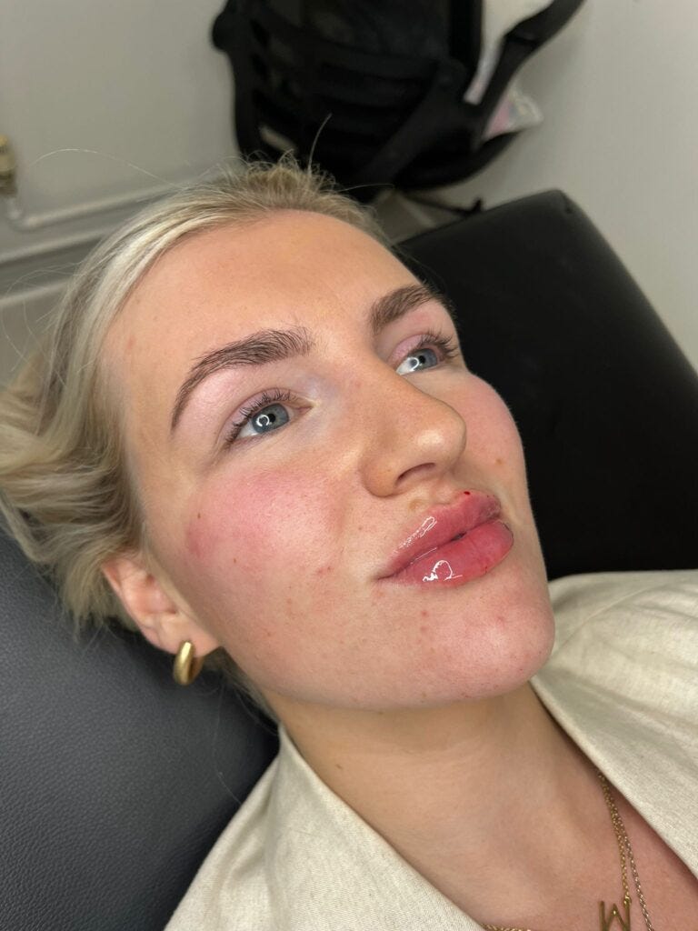 Choosing the Right Botox Clinic in Glasgow: Tips and Considerations | by Angelina's Aesthetics ...