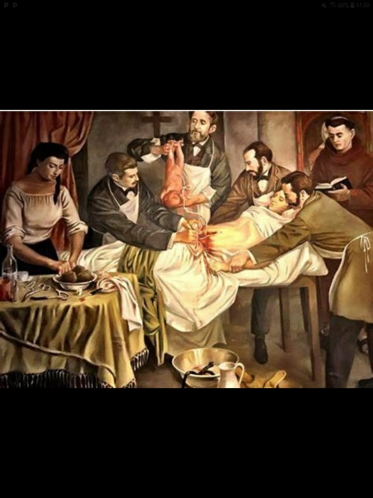 We owe the cesarean section... | by Ifabiyi Olawale | Oct, 2025 | Medium