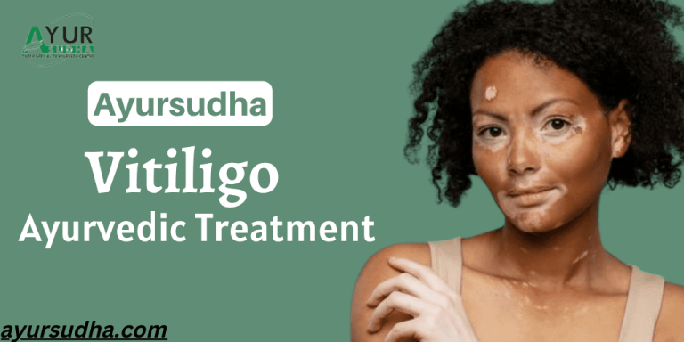 AYURVEDIC KIT FOR VITLIGO LEUCODERMA TREATMENT | by Ayursudha | Medium