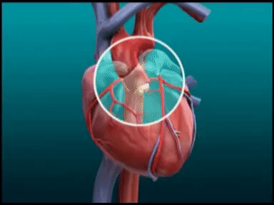 Coronary Circulation Animation