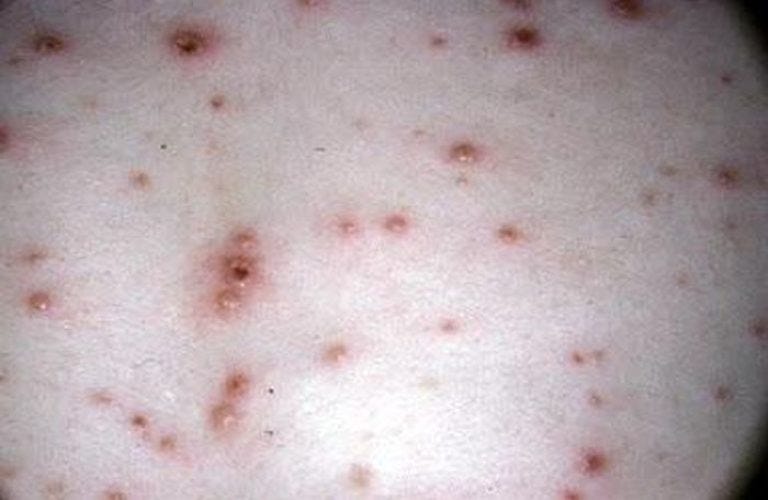 Cảnh báo căn bệnh nguy hiểm sản phụ cần tránh trong suốt thai kỳ | by Van Phuc Care | Medium