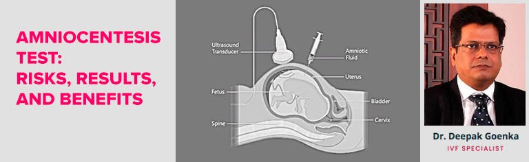 Amniocentesis Results