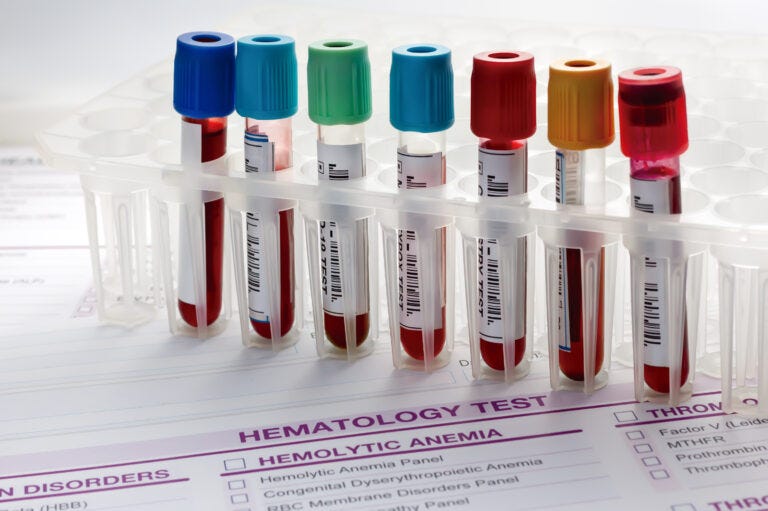 Navigating Wellness: A Guide to Private Blood Tests in Luton | by Ria ...