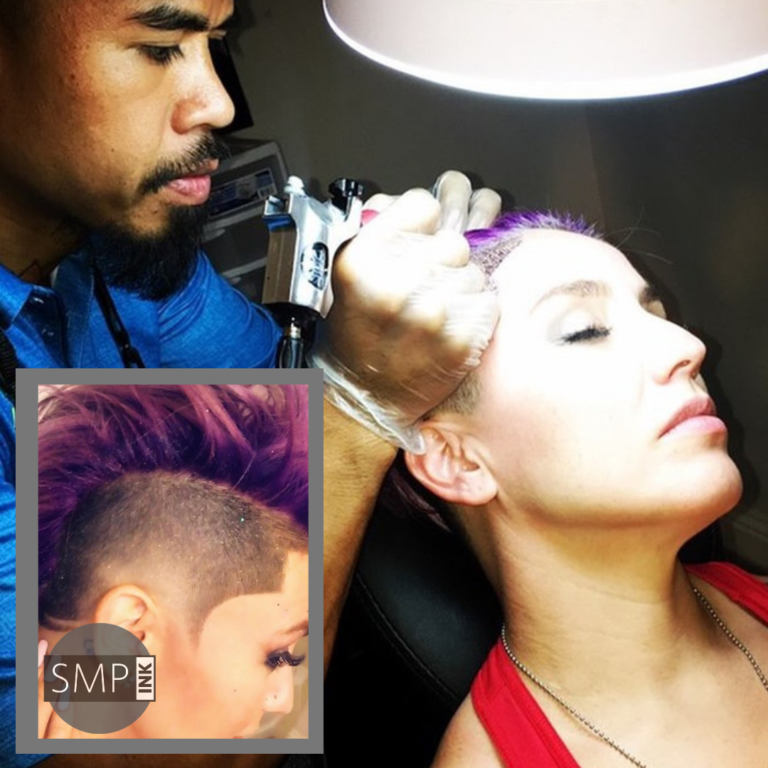 Scalp Micropigmentation for Women | by Jessica Cram | Medium