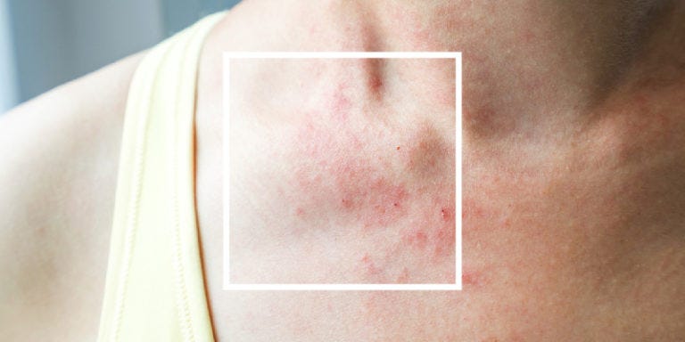 When Sensitive Skin Gets You Down | by MDSUN Skin Care | mdsun.com | Medium