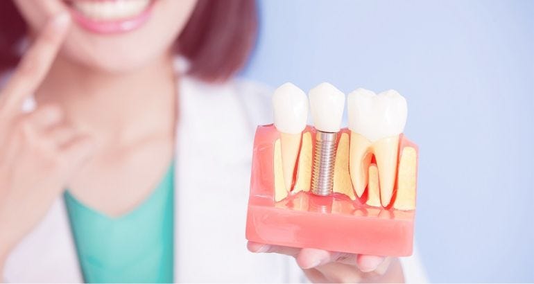 Dental Implants in Chandigarh: A Comprehensive Guide to Restoring Your ...
