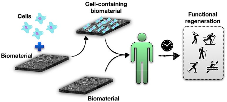 BIOMATERIALS FOR ORGAN AND TISSUE REPAIR…. | by AISWARYA TG 2162843 ...